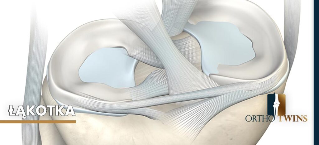 ORTHO-TWINS | Zabiegi operacyjne stawów kolanowych