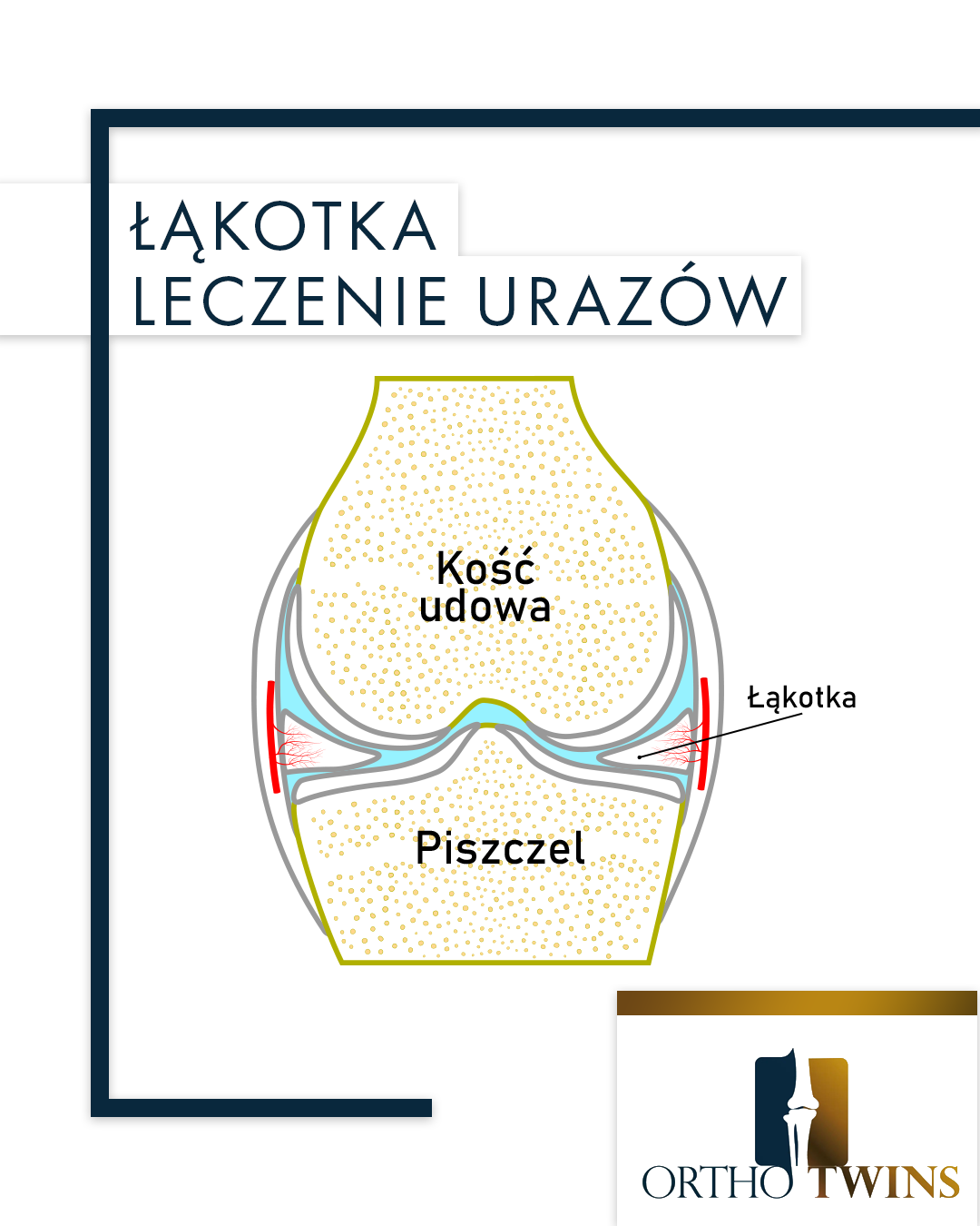 ORTHO-TWINS | Zabiegi operacyjne stawów kolanowych